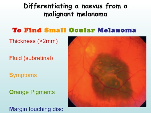Mnemonics of Ophthalmology II | PPT | Eye and Vision Conditions ...