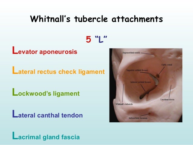 Mnemonics of Ophthalmology II