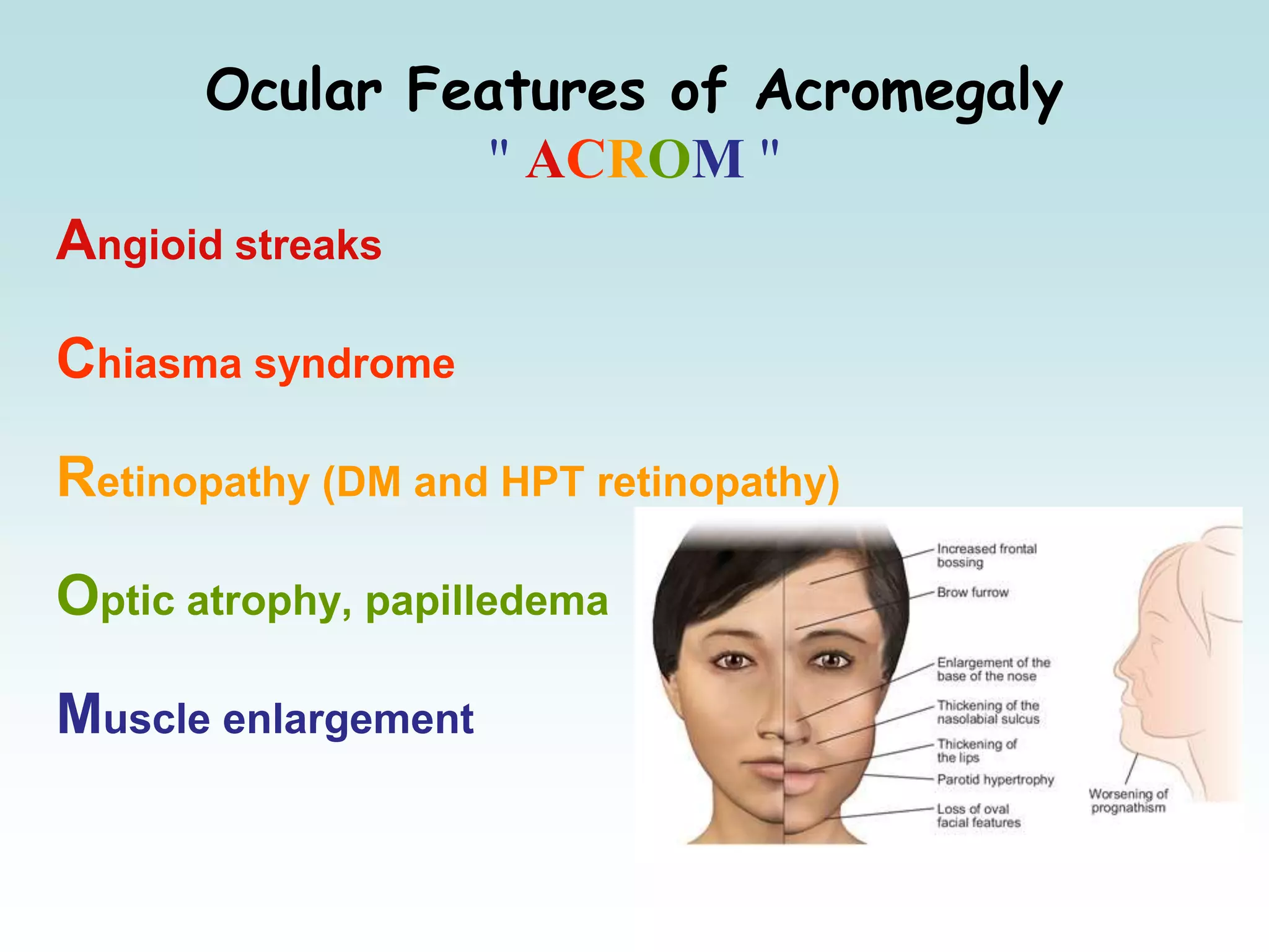 Mnemonics of Ophthalmology III | PPT