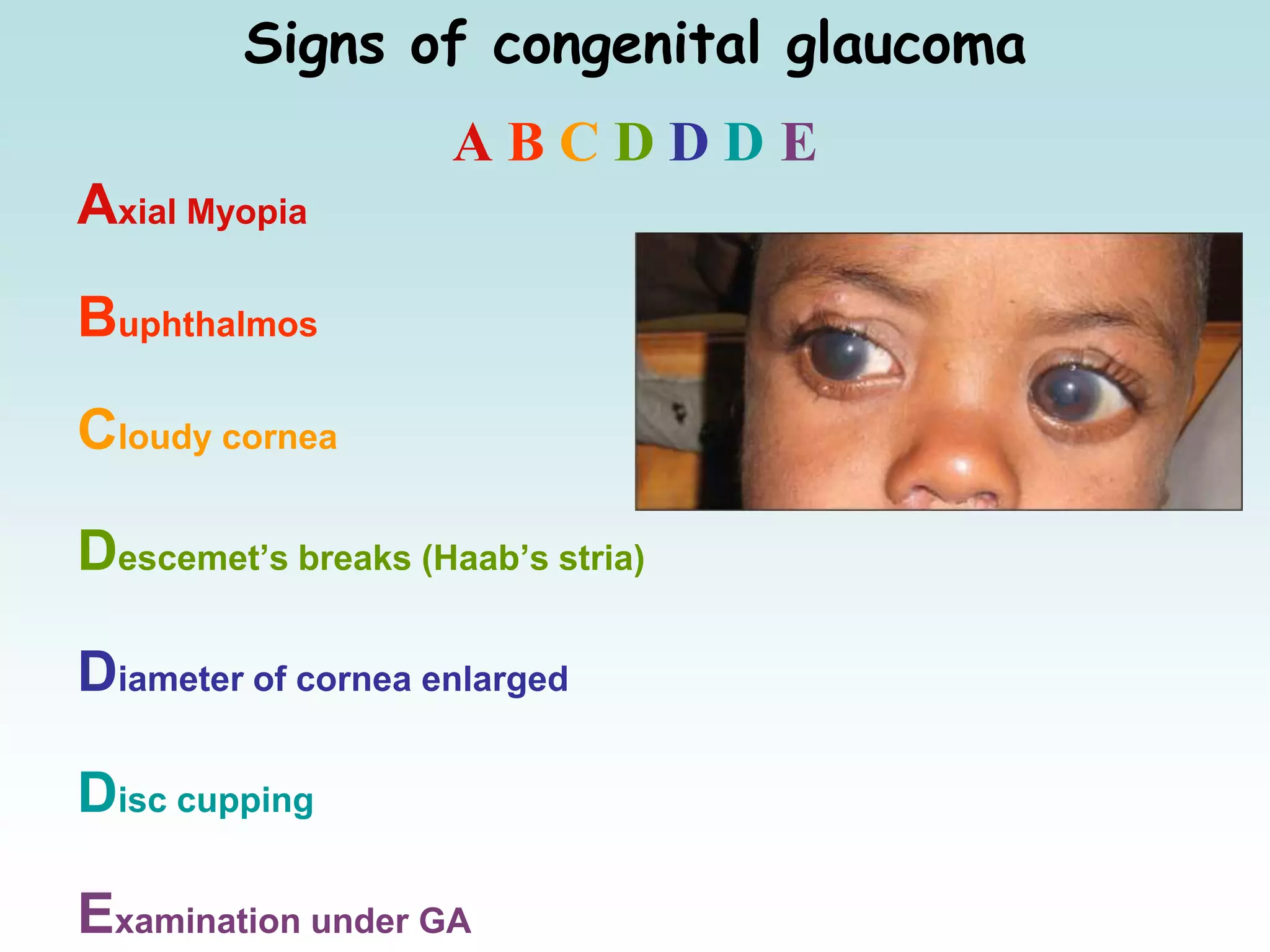 Mnemonics of Ophthalmology III | PPT