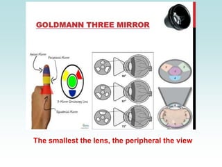 Mnemonics of Ophthalmology III | PPT