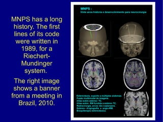 MNPS: Mevis Neurosurgery Planning System. Overview. | PPT
