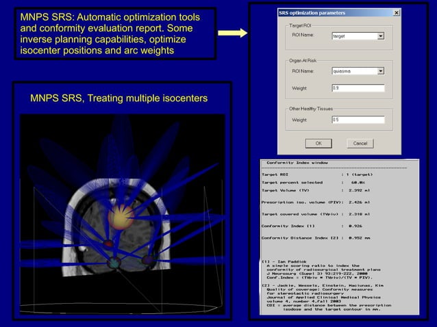 MNPS. Mevis Neurosurgery Planning System. Overview, Aug. 2018 | PPT