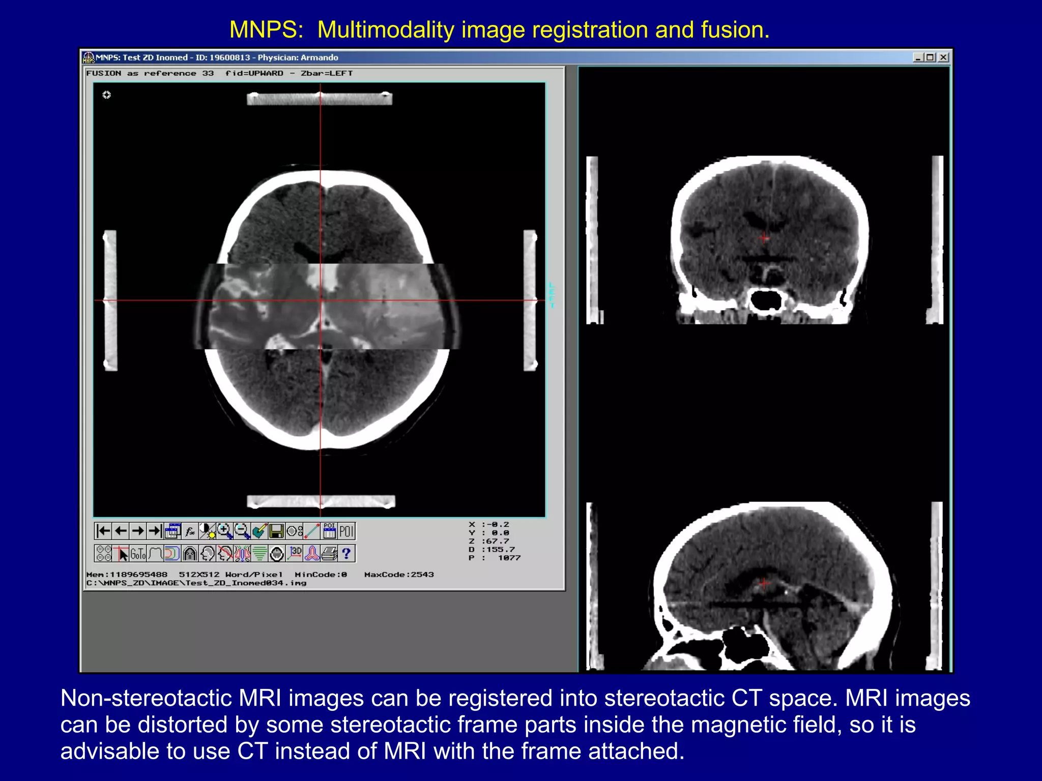 MNPS System Presentation. 2020 | PDF