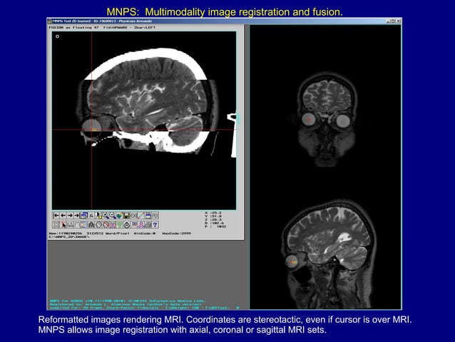 MNPS System Presentation. 2020 | PDF | Medical Tests | Medical Health