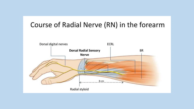 Median to Radial Nerve Transfers (FDS to ECRB, FCR to PIN) cadaveric ...