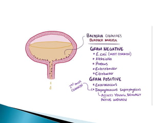 pyelonephritis in pregnancy | PPTX