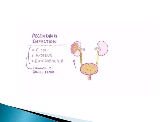 pyelonephritis in pregnancy | PPTX