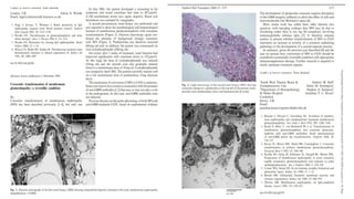 Adult onset nephro syndrome................ | PPT
