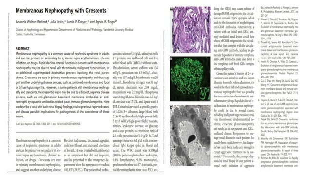 Adult onset nephro syndrome................ | PPT