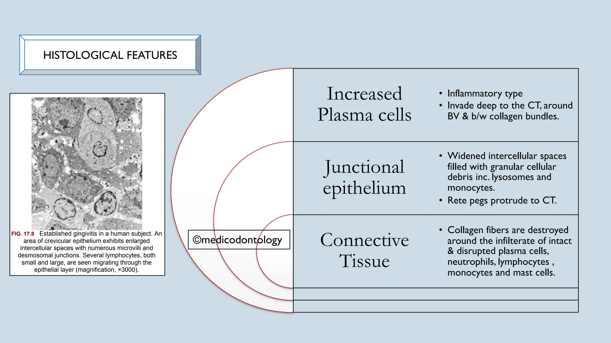 PERIODONTICS- GINGIVAL INFLAMMATION- | PDF