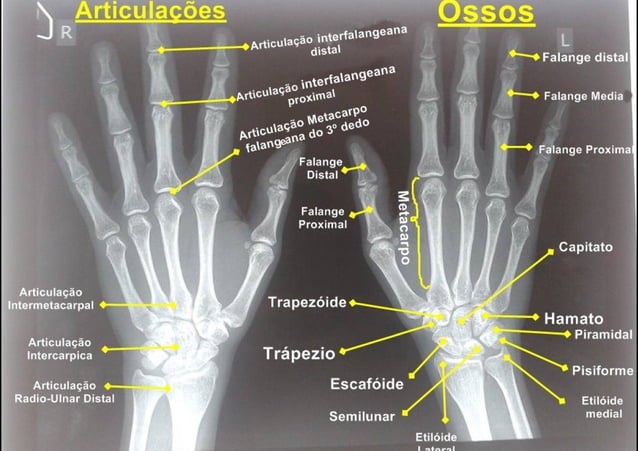Mão - Anatomia Radiológica | PPT