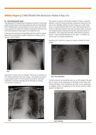 White Paper: The Benefits of Mobile X-rays in Thoracic and Cardiac Care ...