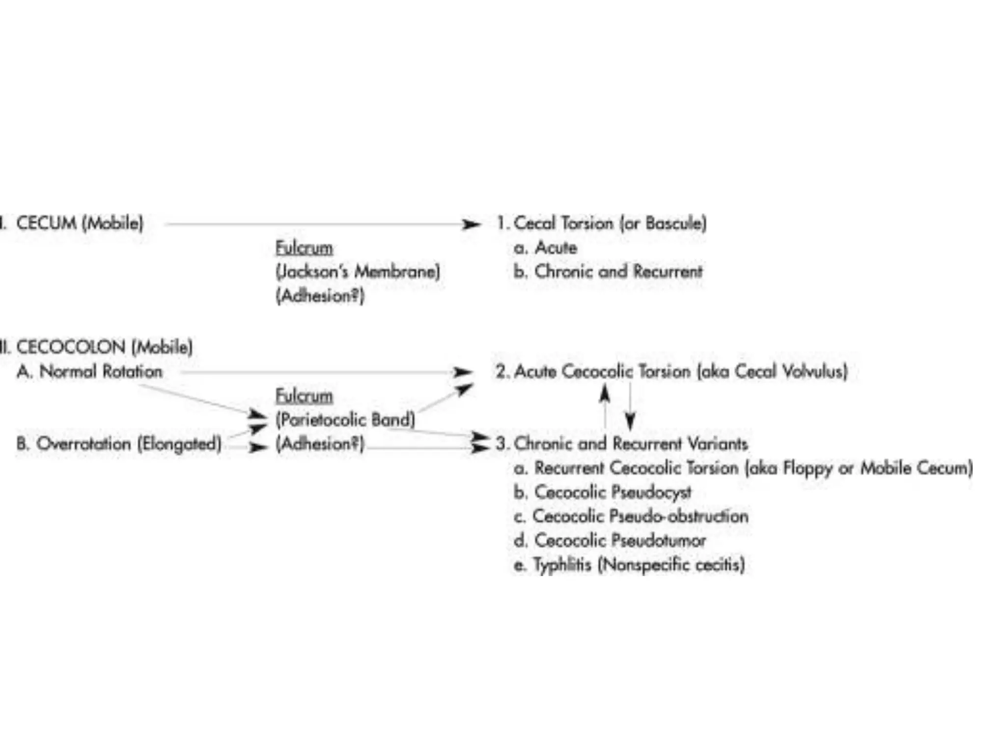 Mobile cecum syndrome | PPTX