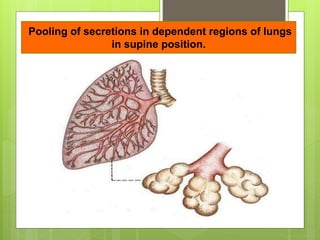 early Mobility in ICU | PPTX