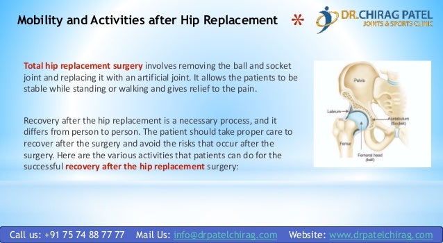 Mobility And Activities After Hip Replacement Hip Orthoinfo Dr