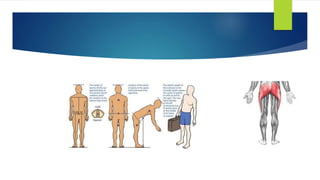 Mobility and immobility | PPTX