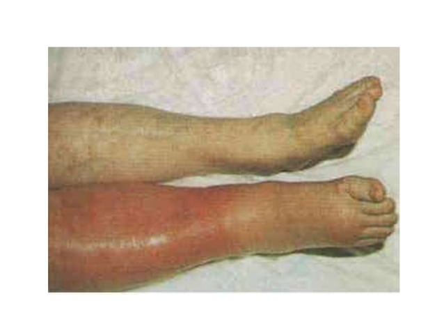 MOBILITY & IMMOBILITY.ppt