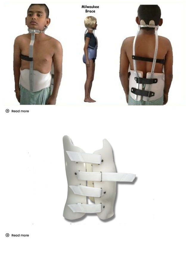 Mobillitysolution in-cervical-and-spinal-orthosis | PDF