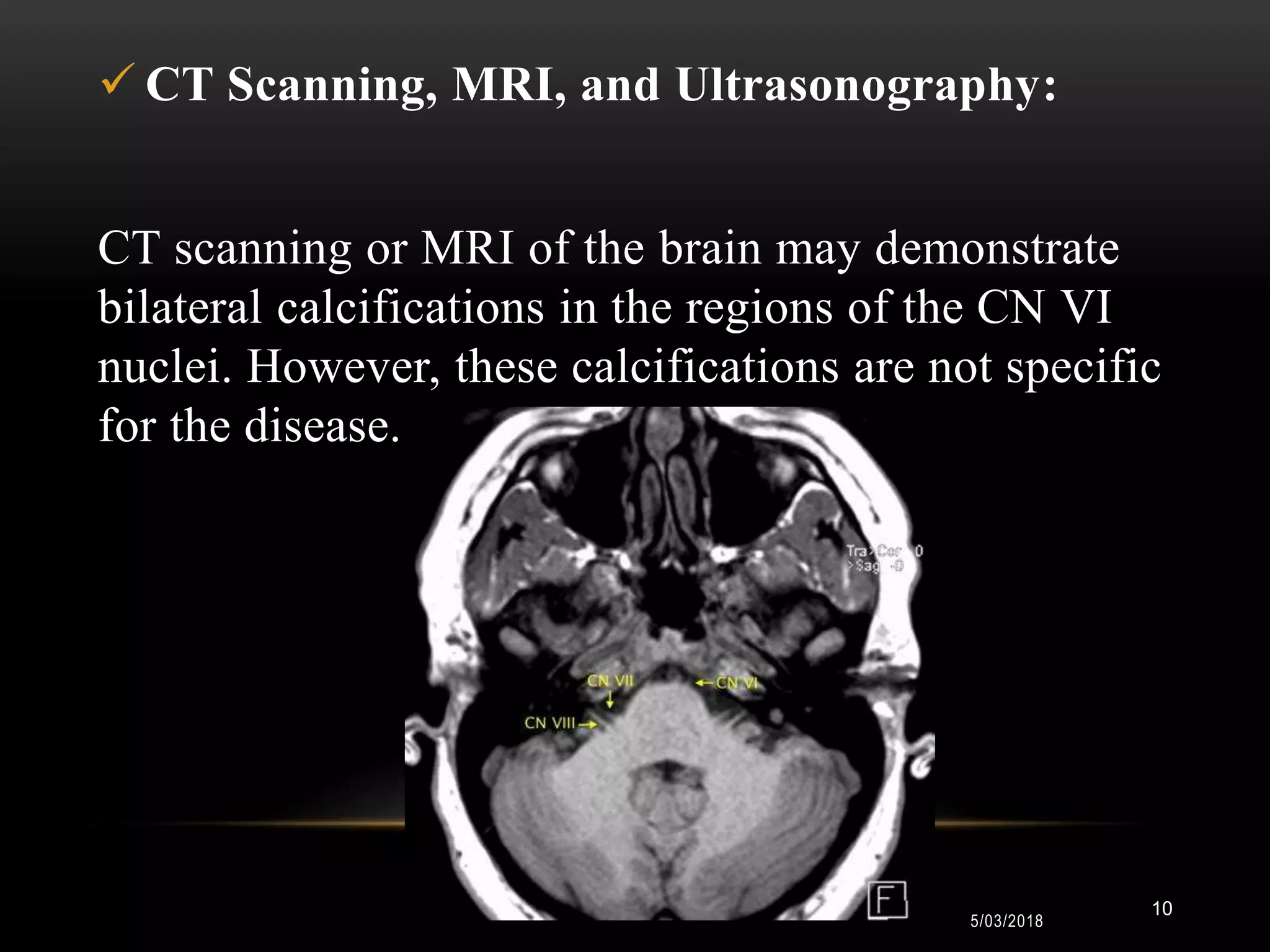 Mobius syndrome 2018 | PPTX | Brain and Nervous System Disorders ...