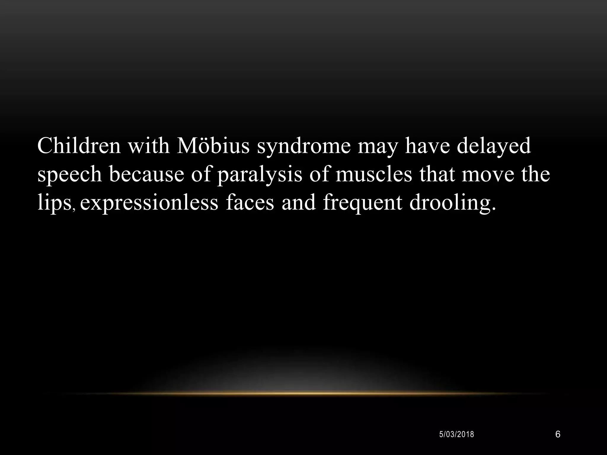 Mobius syndrome 2018 | PPTX
