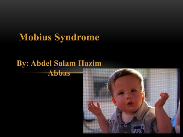 Mobius syndrome 2018 | PPTX | Brain and Nervous System Disorders ...