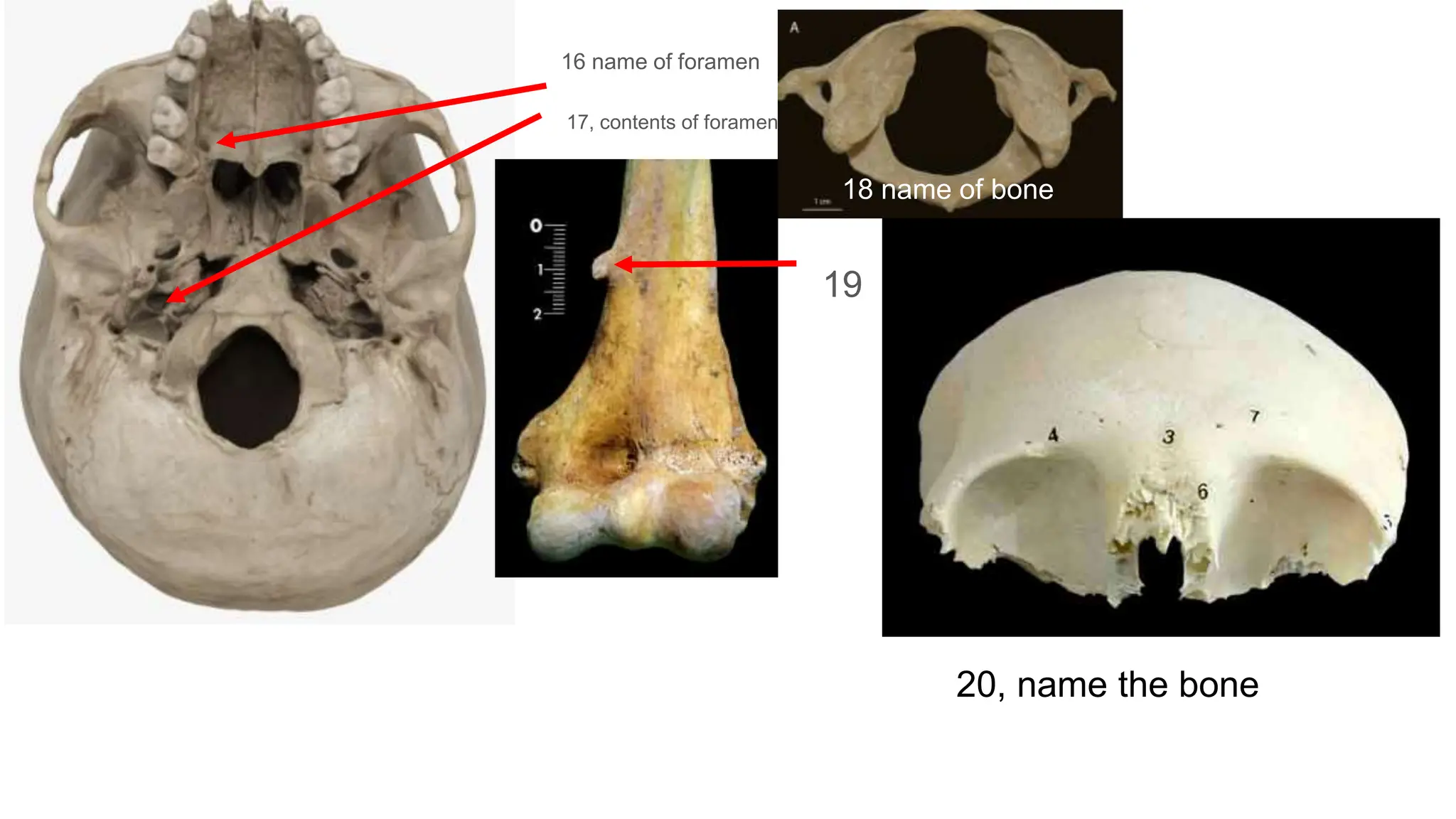 Anatomy Spotter Test For Medical Students | PPTX