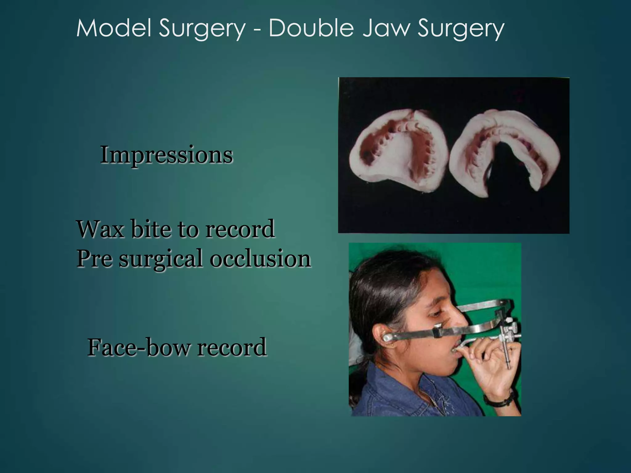 Mock surgery,softwares & advances orthognathic | PPTX