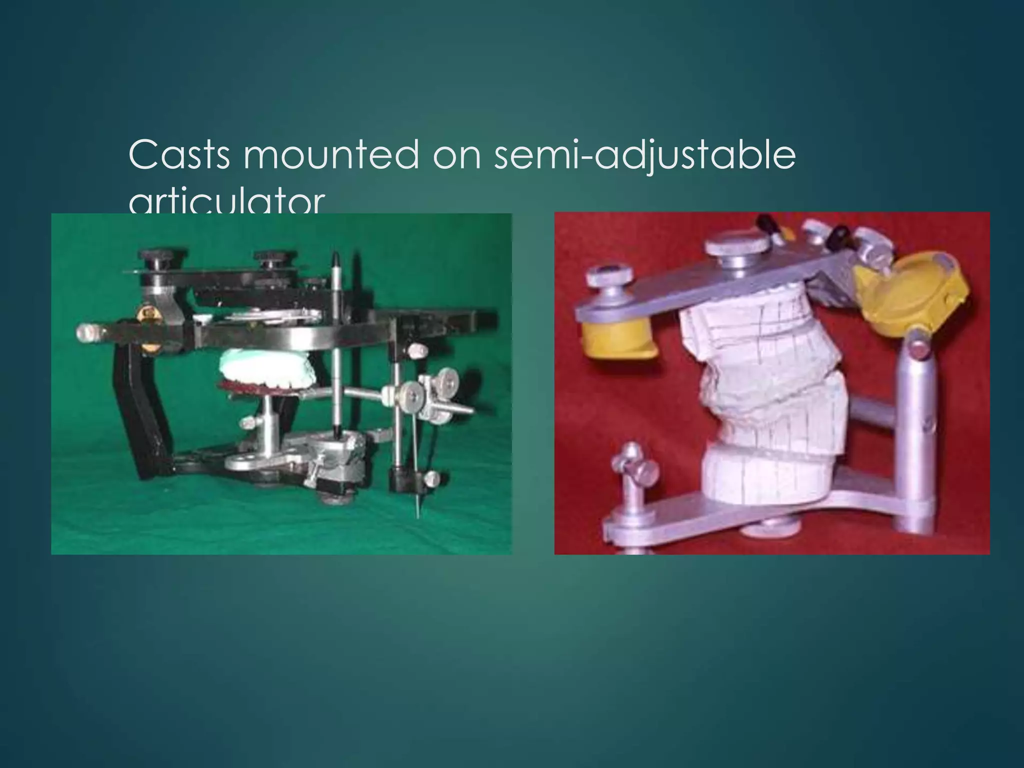 Mock surgery,softwares & advances orthognathic | PPTX