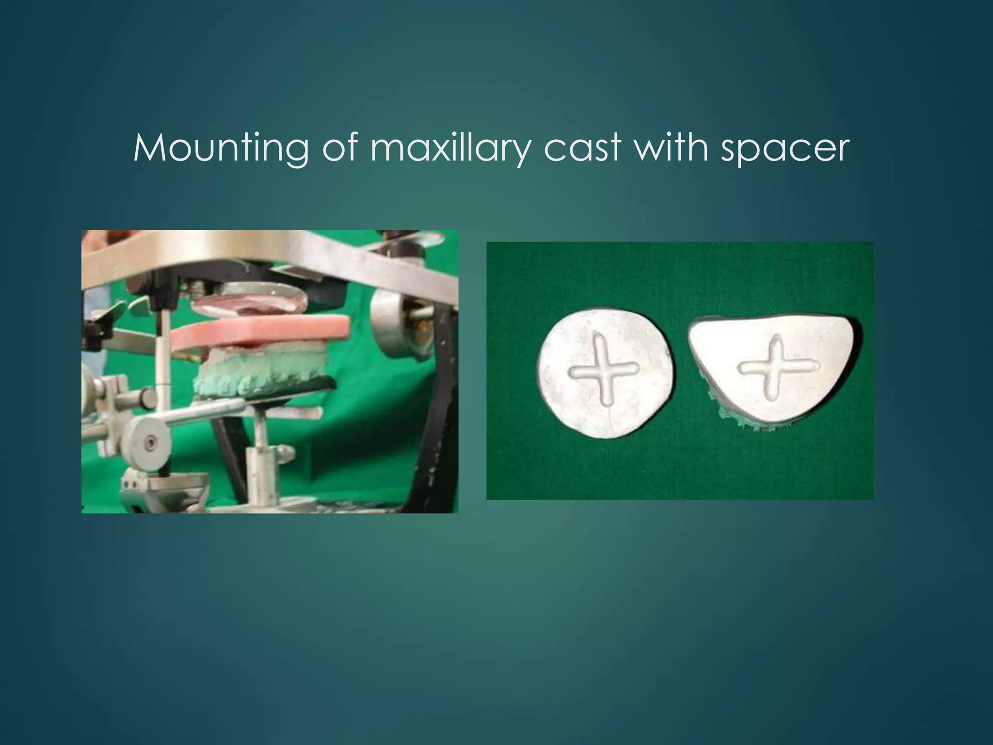 Mock surgery,softwares & advances orthognathic | PPTX