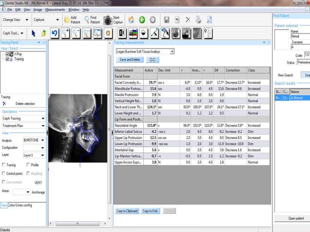 Mock surgery,softwares & advances orthognathic | PPTX