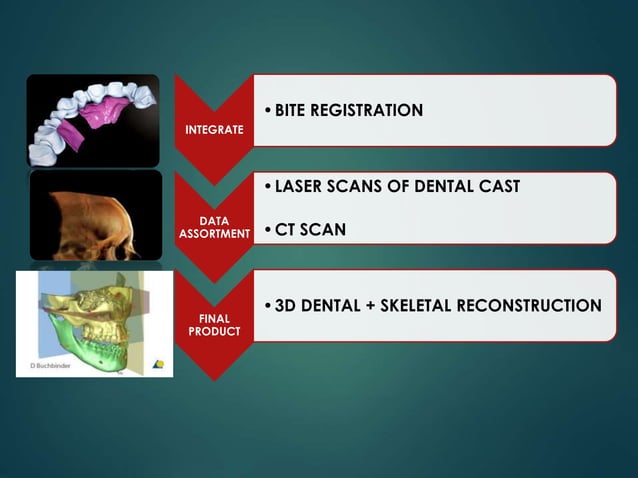 Mock surgery,softwares & advances orthognathic | PPTX
