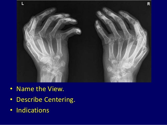 Mock test for imm radiology DR. Muhammad BIn Zulfiqar