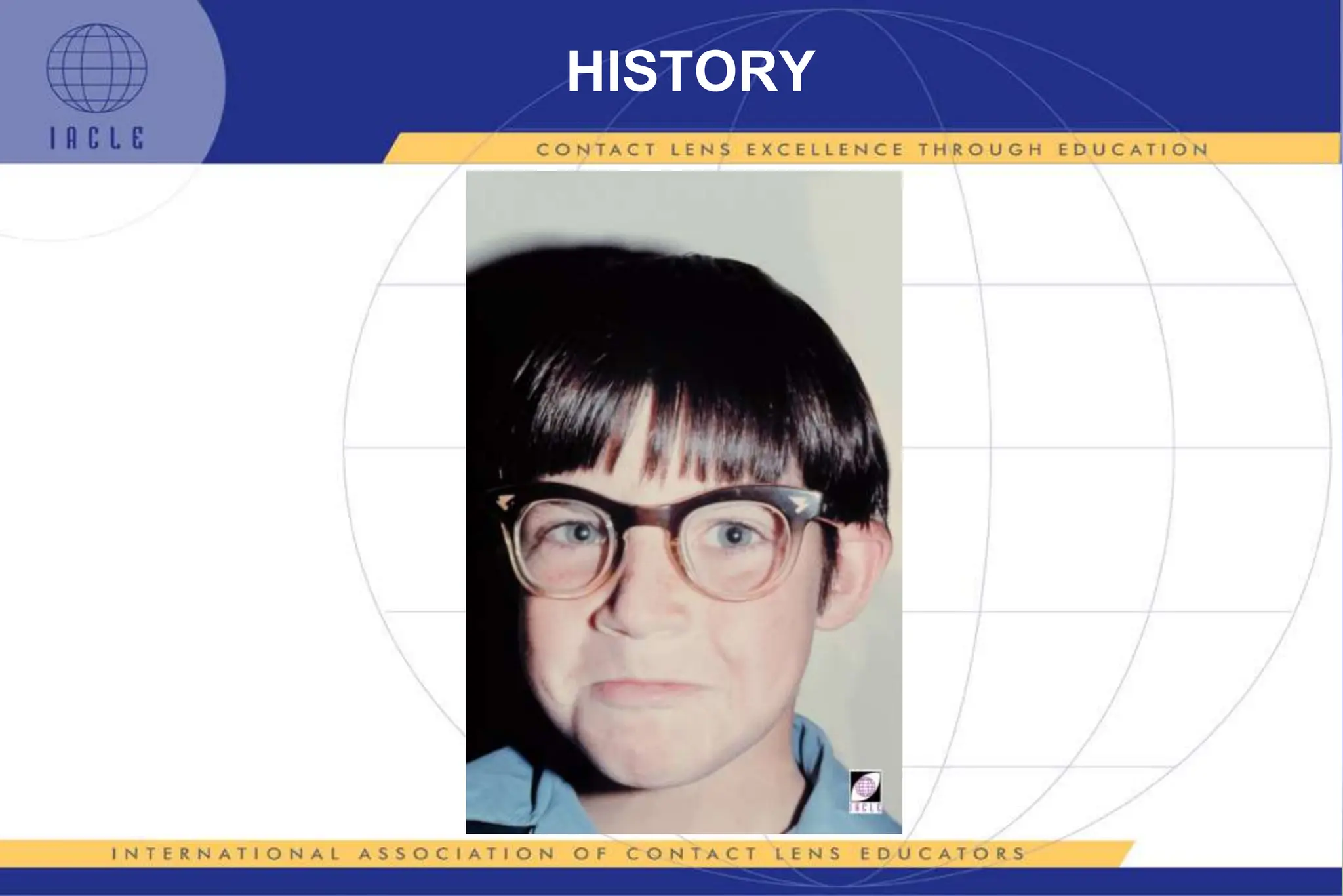 Introduction to Contact Lens Fitting_ Module 3.1 | PPTX