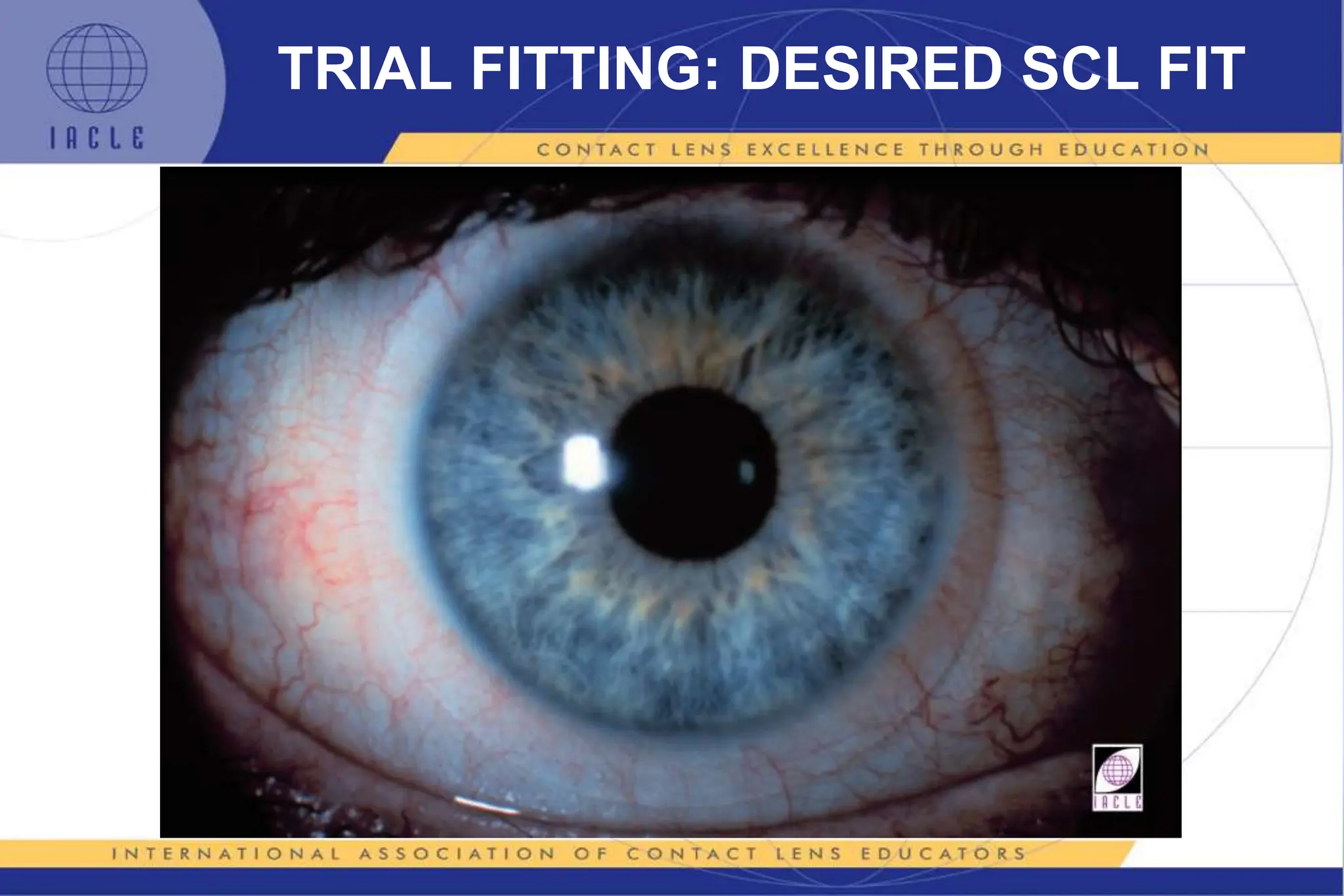 Introduction to Contact Lens Fitting_ Module 3.1 | PPTX