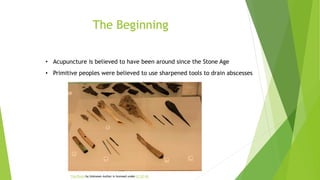 Brief History of Acupuncture | PPTX