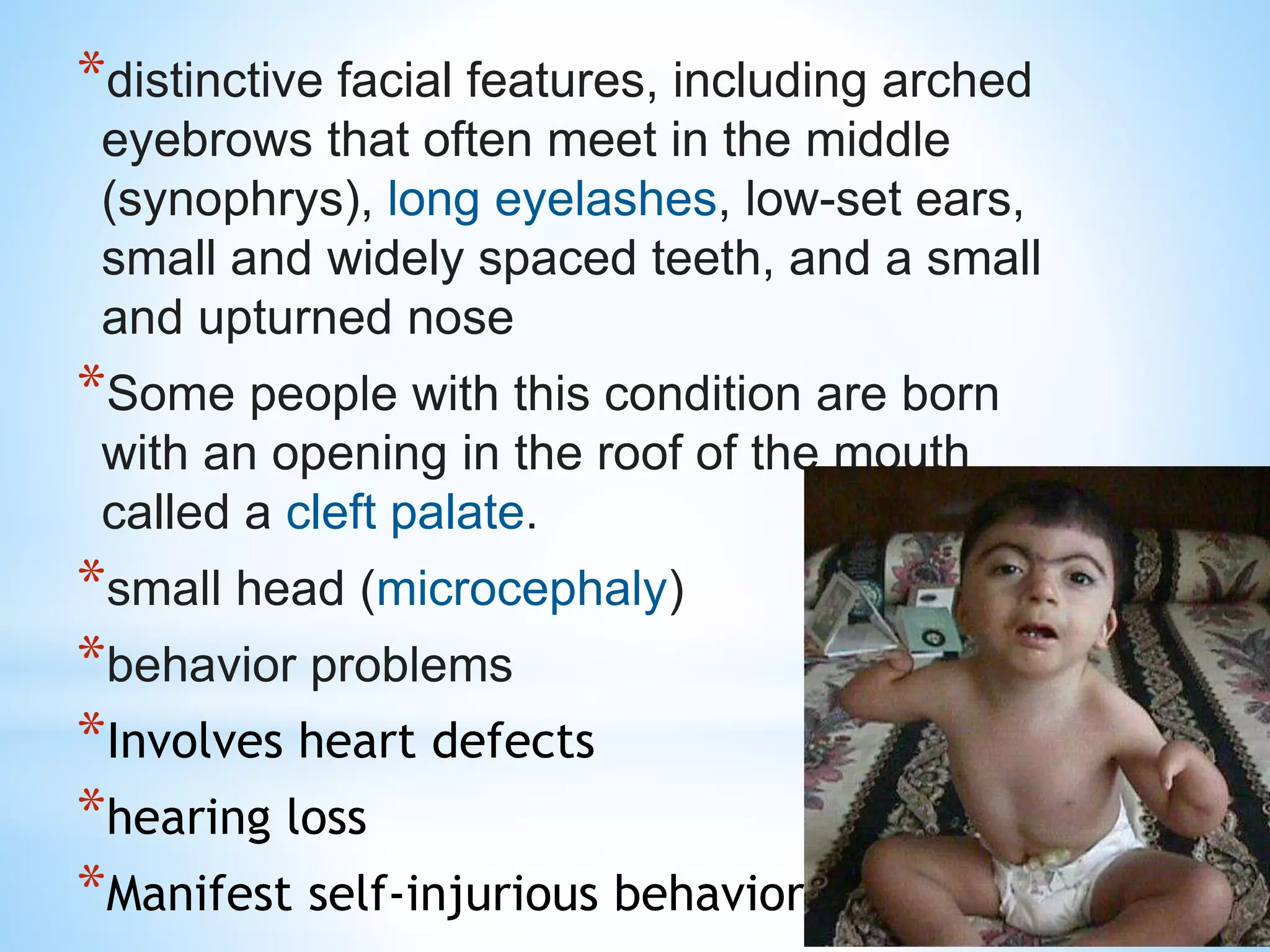 General guidelines for intellectual and developmental disabilities | PPTX