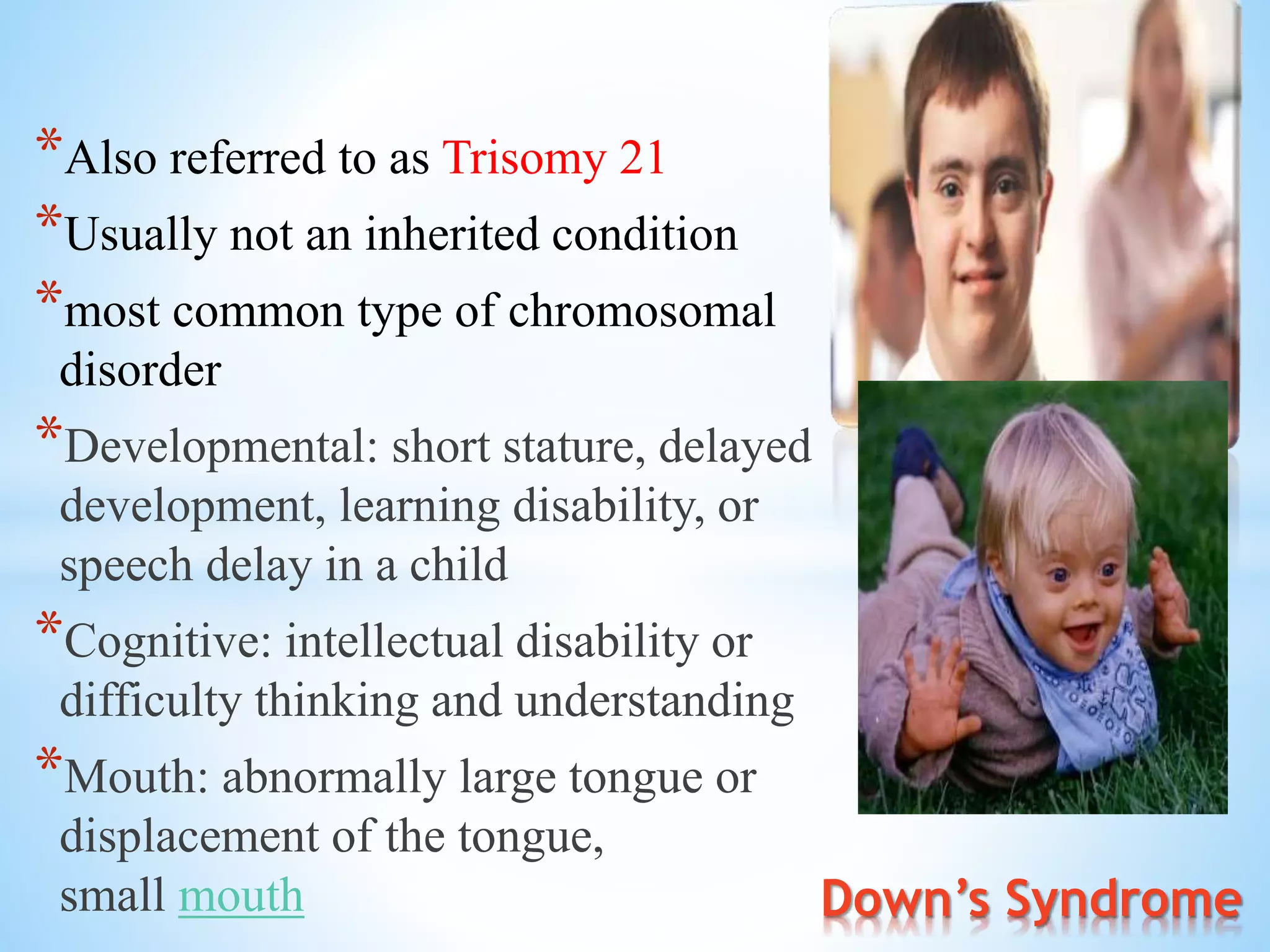 General guidelines for intellectual and developmental disabilities | PPTX