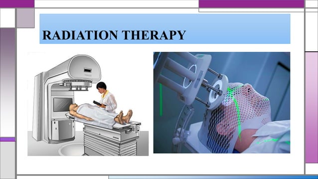 Modalities of treatment for cancer | PPTX