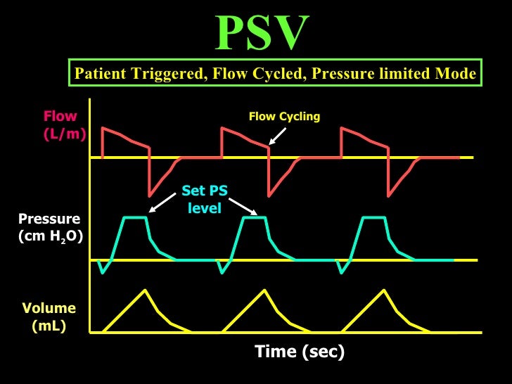 Mode Of Mechanical Ventilator