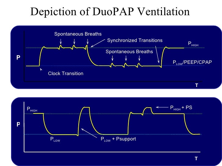 Mode Of Mechanical Ventilator