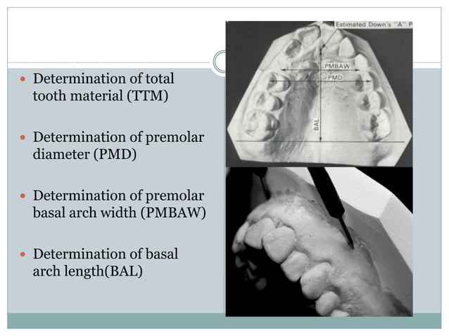 Model analysis in orthodontics | PPTX