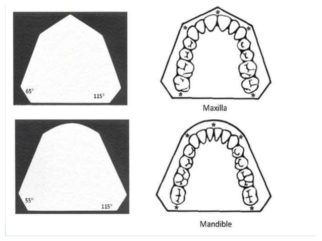 Model analysis in orthodontics | PPTX
