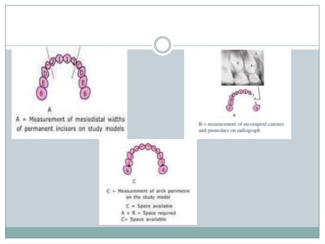 Model analysis in orthodontics
