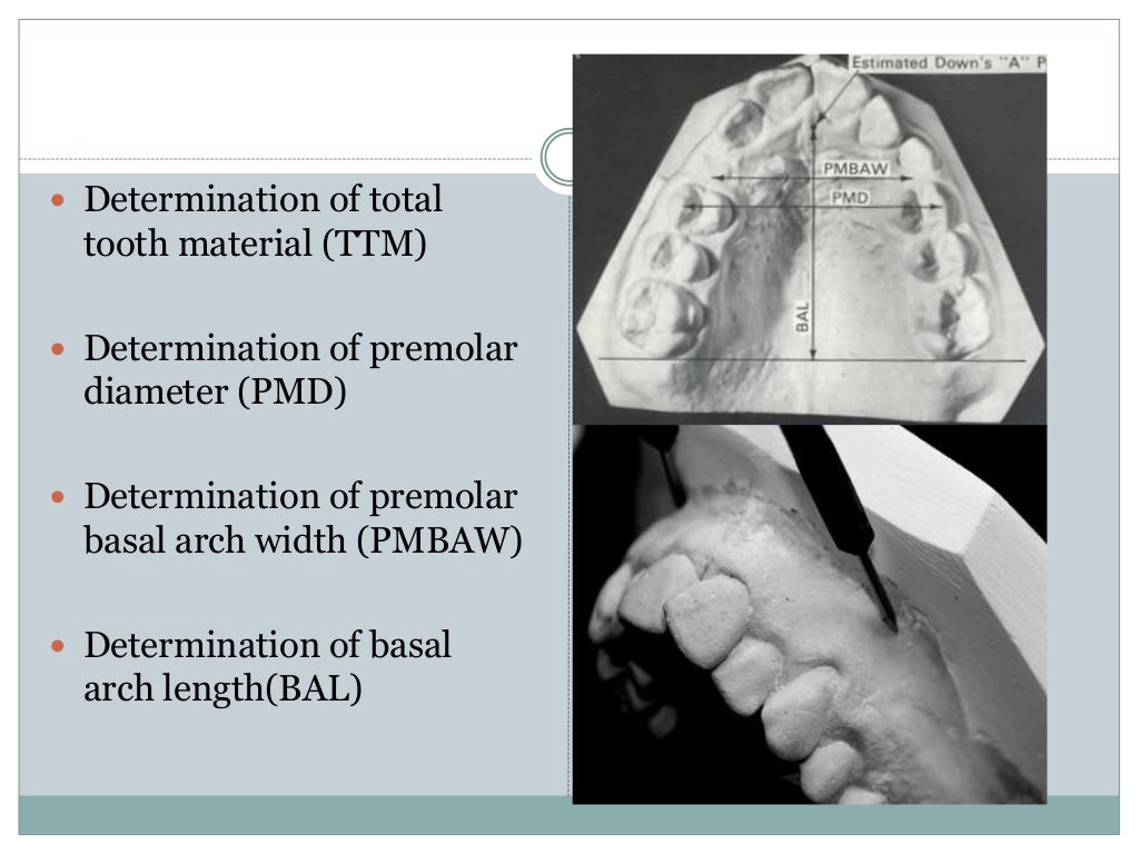Model analysis in orthodontics