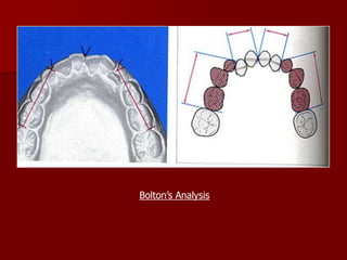 Model Analysis | PPT
