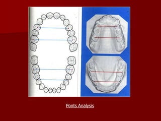 Model Analysis | PPT