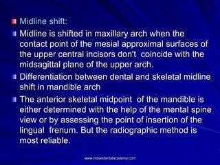Model analysis 1 | PPT