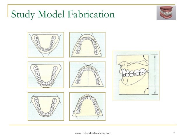 Model analysis in orthodontics /certified fixed orthodontic courses b…