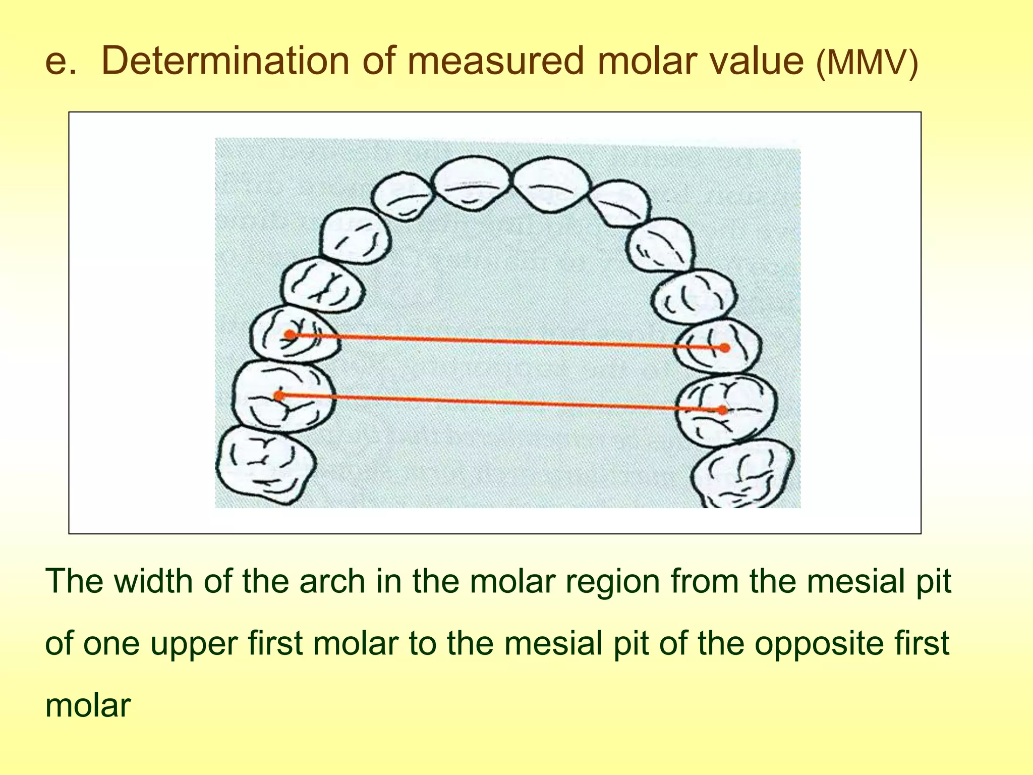 Model analysis.ppt